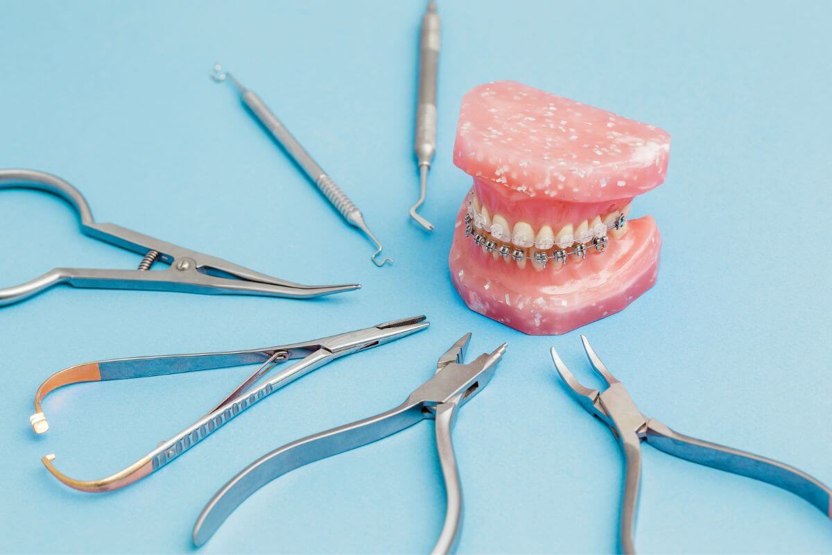 5 razloga kada je vađenje zuba neophodno - Dental Centar Mirakul