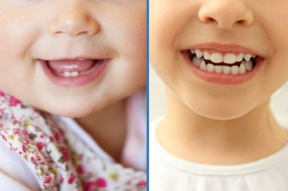 Znate li koliko čovjek ima zuba i koju ulogu imaju? - Dental Centar Mirakul
